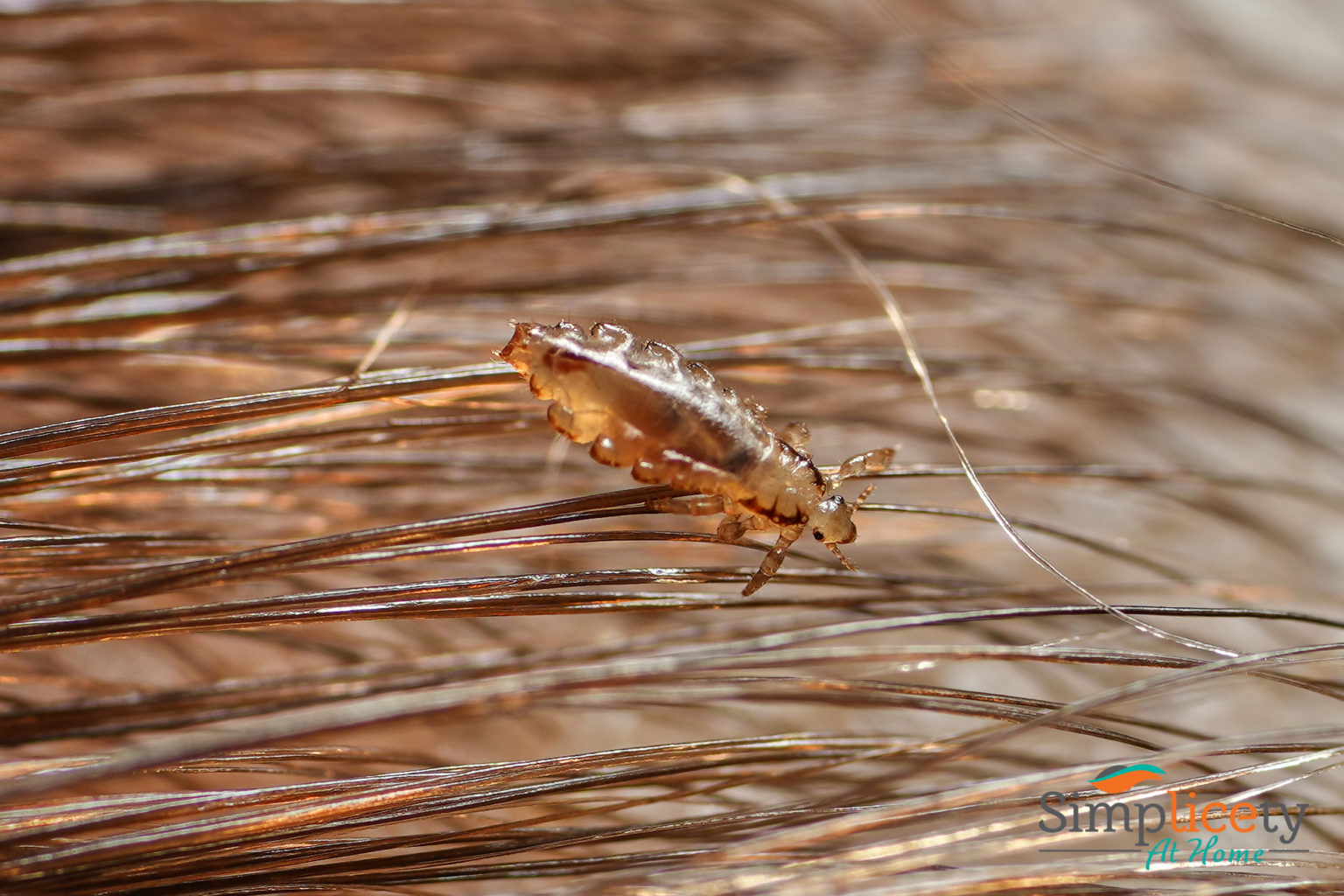 Circle of Lice - Home Lice Treatment Kit & Removal by Simplicety at Home